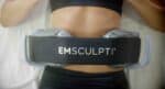 Emsculpt Neo Chicago IL - Body Sculpting Lincoln Park IL